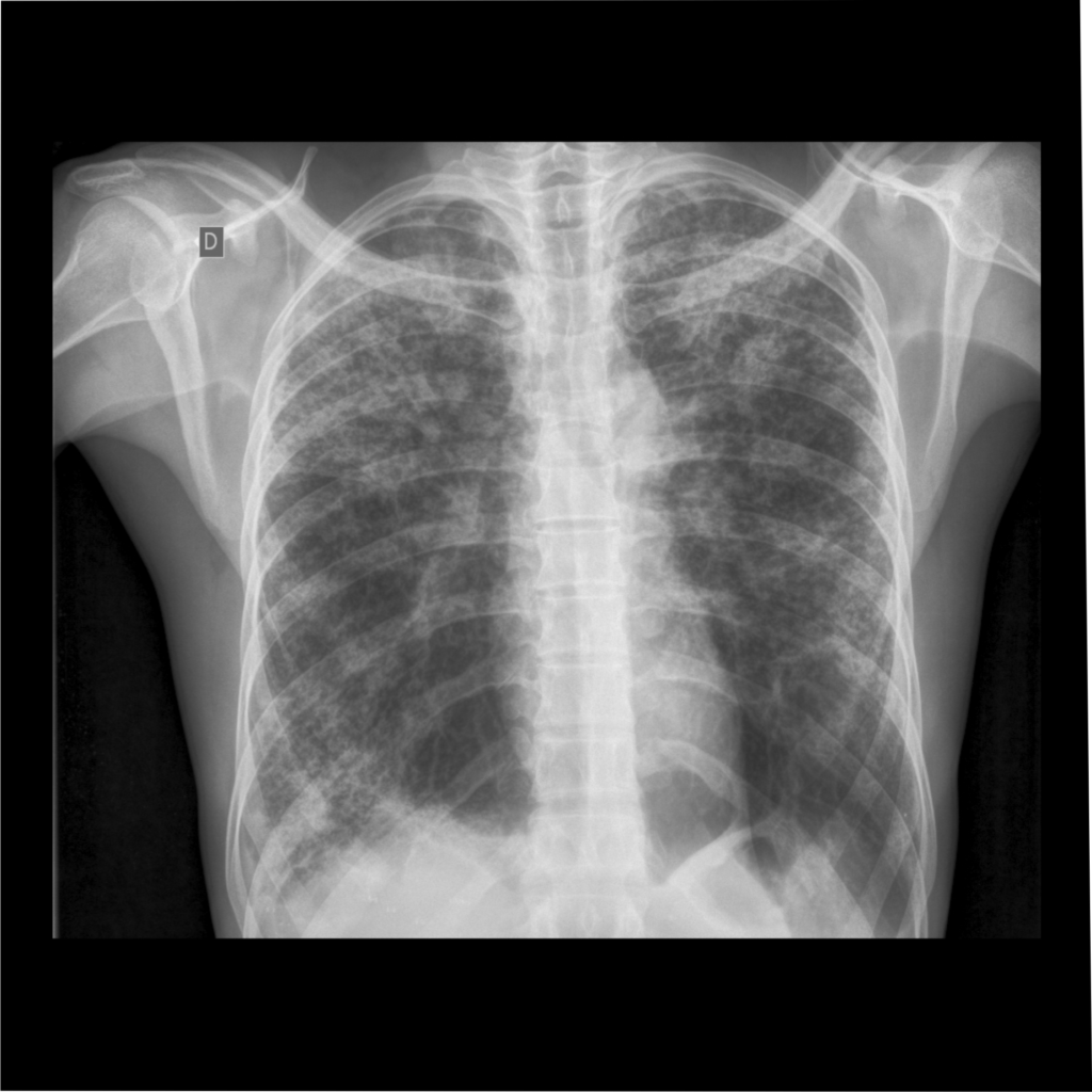 RX TÓRAX PA-OIT - CDI Dr. Matsushita - Centro de Diagnósticos