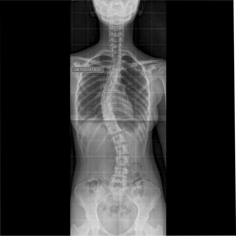 RX PANORÂMICO DE COLUNA VERTEBRAL - CDI Dr. Matsushita - Centro de ...